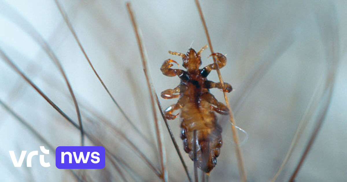 "Meer luizen bij het begin van het schooljaar is een fabeltje" | VRT ...