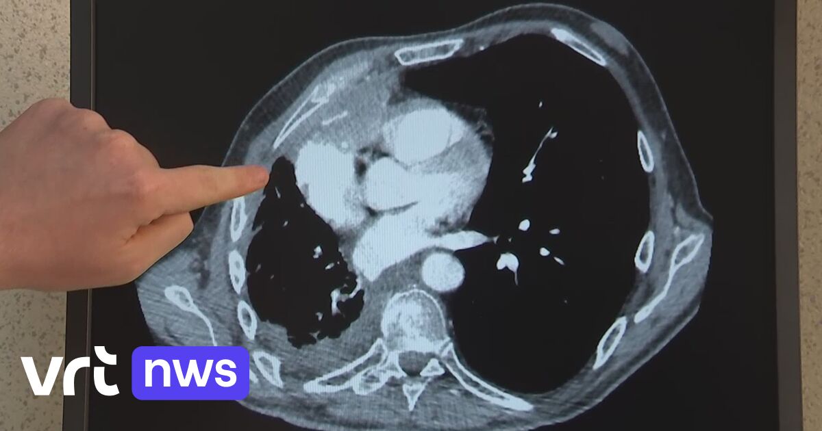 Antwerpse wetenschappers ontwikkelen eenvoudige ademtest om ...