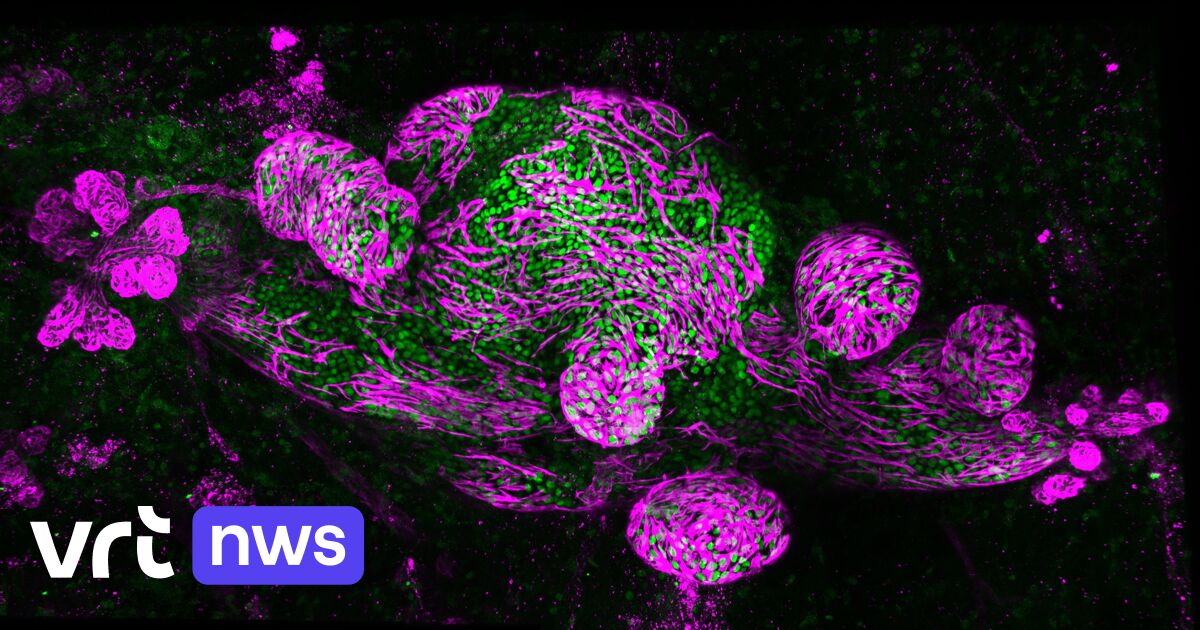 Onderzoekers vinden manier om ontwikkeling van borstkanker beter te ...
