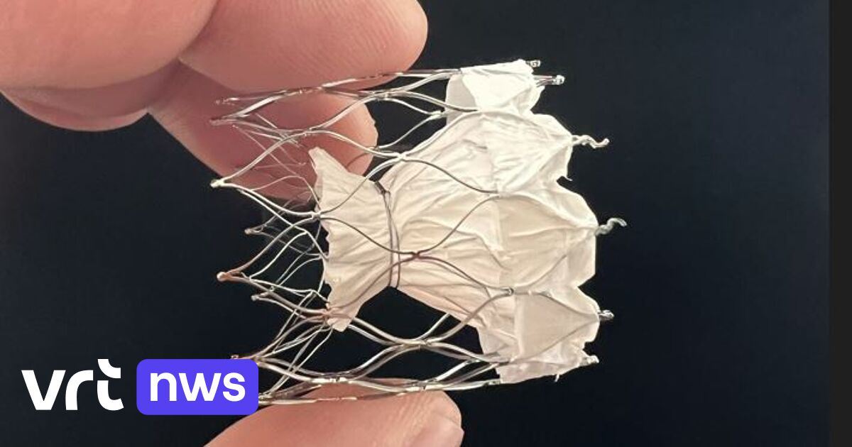 Antwerpse ziekenhuizen plaatsen voor het eerst stents in longslagaders ...