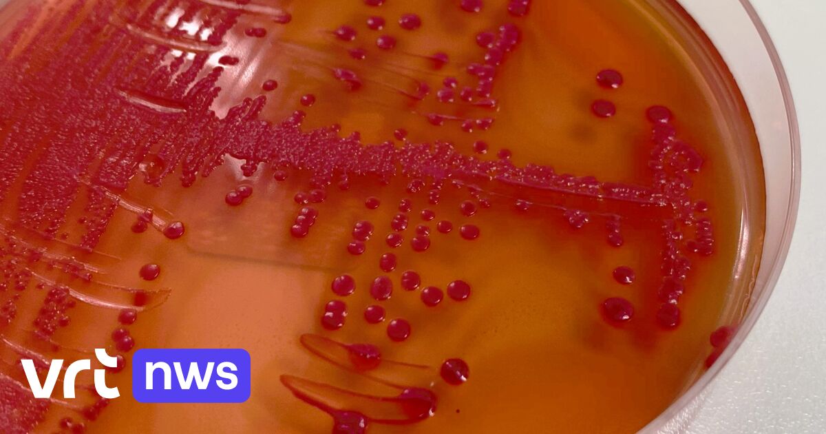 Raw minced beef “the likely source” of STEC infection that claimed 9 ...