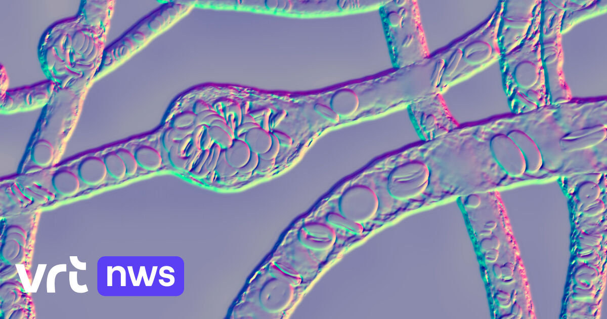 Uitstulping van bloedvat die fataal kan aflopen: wat is hersenaneurysma ...