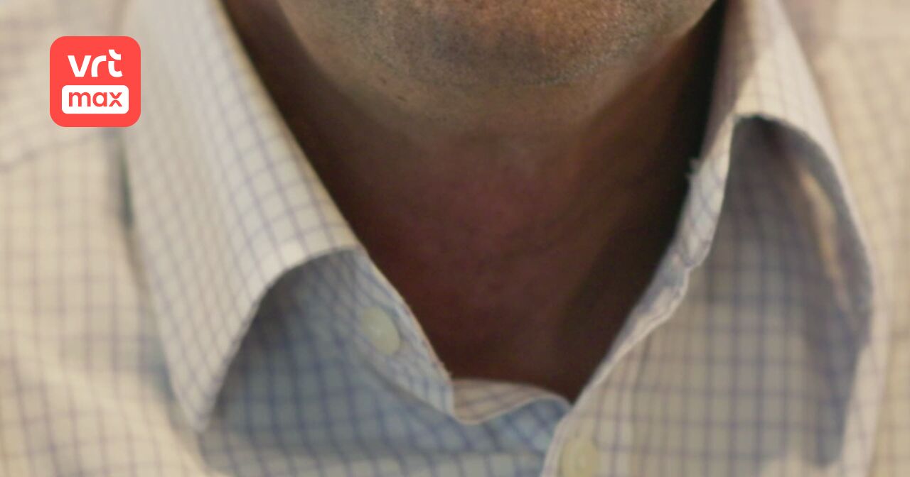 Super surgeons - 3 (1) | VRT MAX