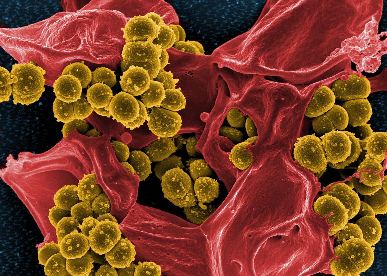 De 'superbacterie' MRSA is lang voor het medisch gebruik van ...
