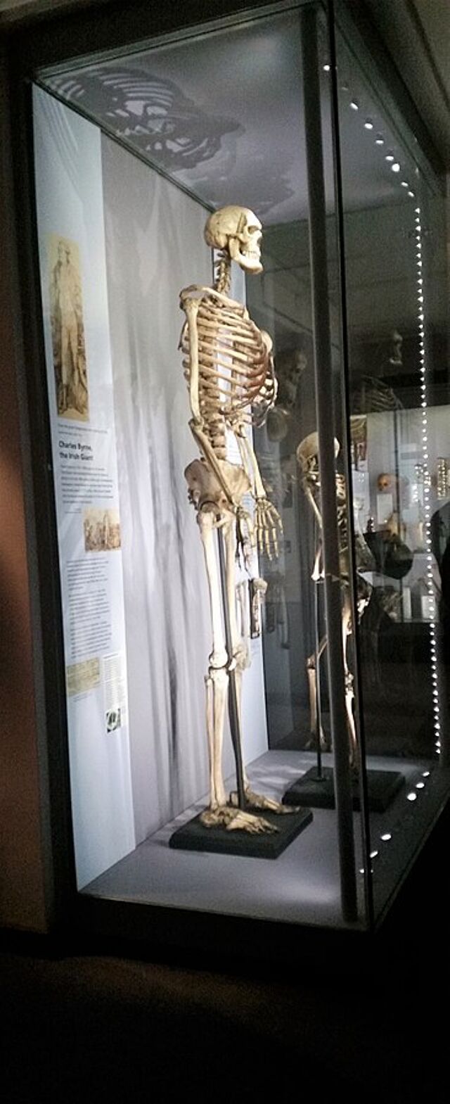 Skelet van "Ierse reus" verdwijnt na meer dan 200 jaar uit Londens ...