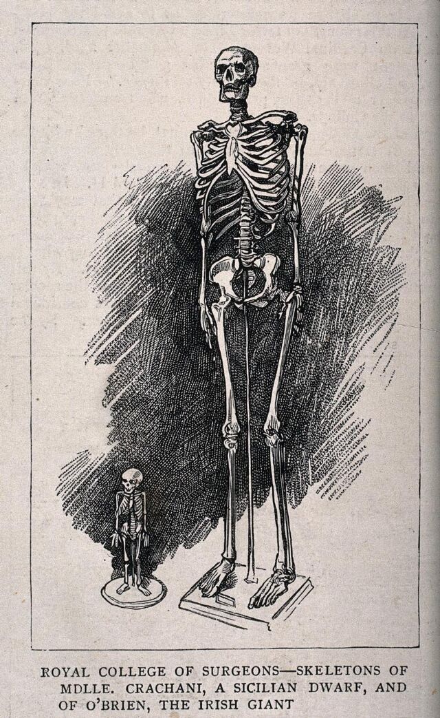 Skelet van "Ierse reus" verdwijnt na meer dan 200 jaar uit Londens ...