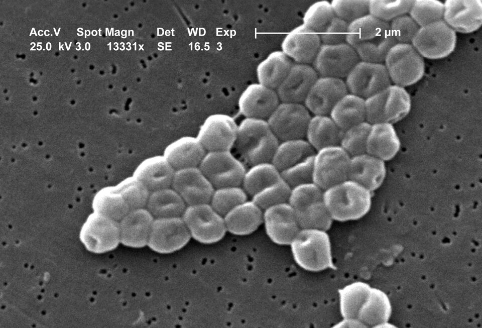 'Laatste kans'-antibioticum prikt bacteriën lek alsof het ballonnen ...