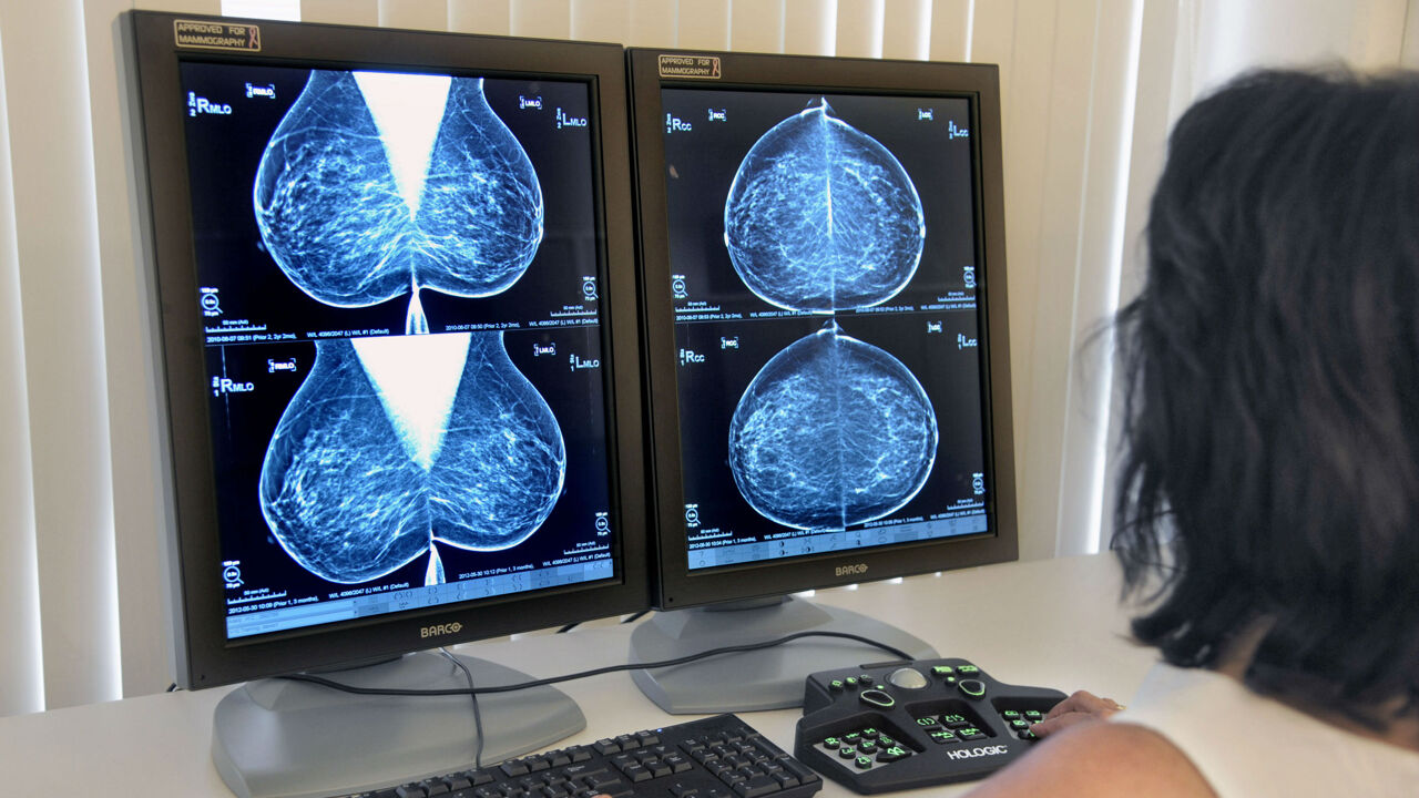 Ziekenhuis in Aalst gebruikt robotchirurgie voor tepelsparende ...