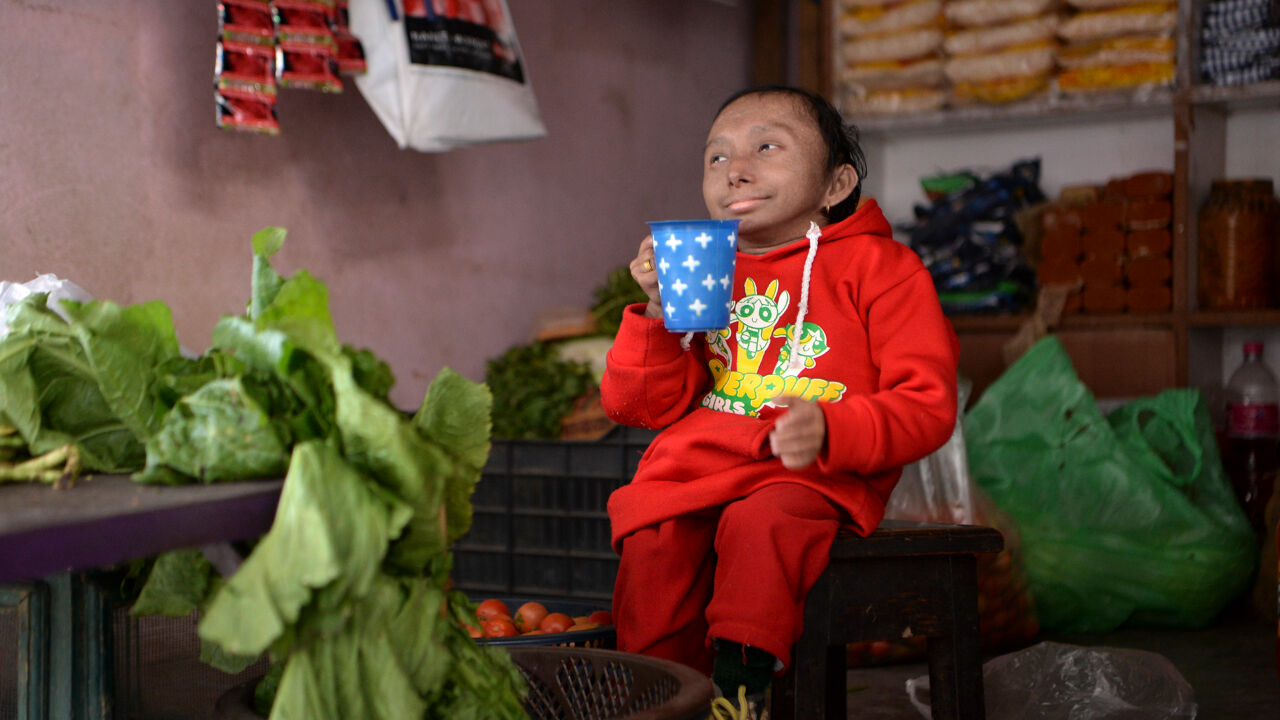 De kleinste man ter wereld die kan stappen, is overleden op 27-jarige ...