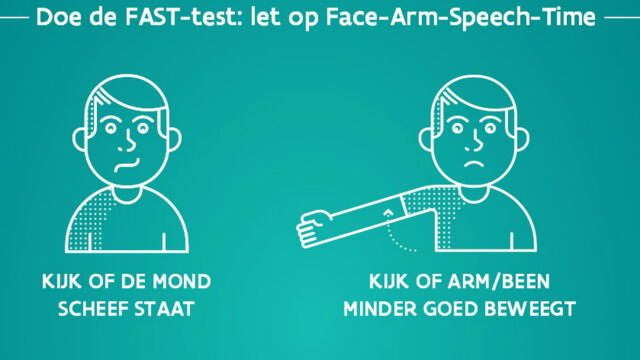 Hoe herkent u eenvoudig een beroerte? Doe de FAST-test | VRT NWS: nieuws