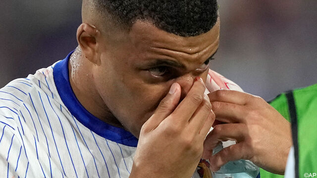 Kylian Mbappé hoeft niet geopereerd te worden aan gebroken neus: "Heeft ...