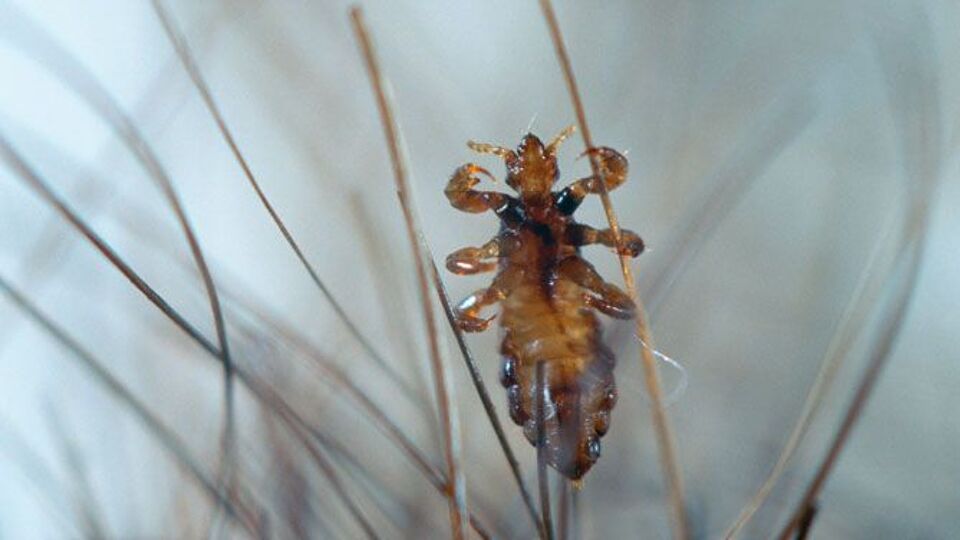 Van luizenkam, over luizenshampoo tot heuse luizenkliniek: wat helpt ...