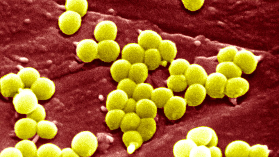 Antibiotica ontdekt die bacteriën doden op een nieuwe manier | VRT NWS ...